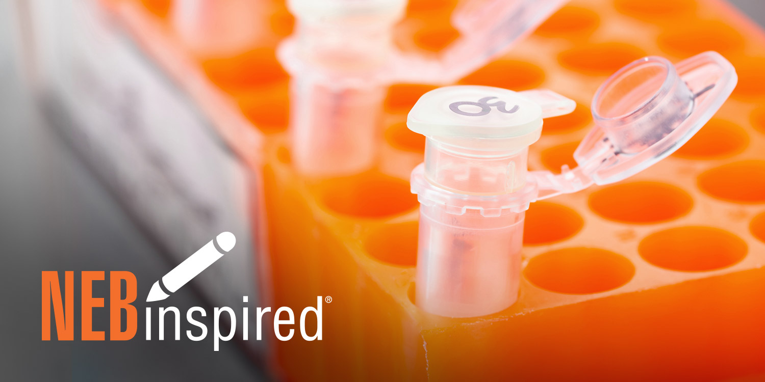 Expert Tips & Tricks for Plasmid DNA Purification Using Miniprep Kits | NEB