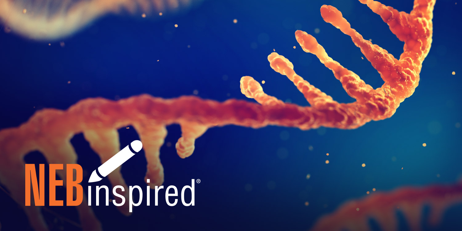 Navigating mRNA IVT | NEB