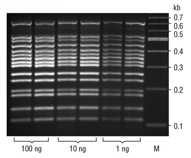 Anatomy of a Polymerase - How Function and Structure are Related | NEB